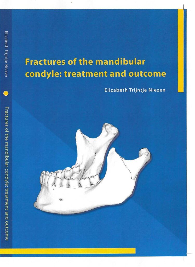 Fractures of the mandibular condyle: treatment and outcome - NVMKA