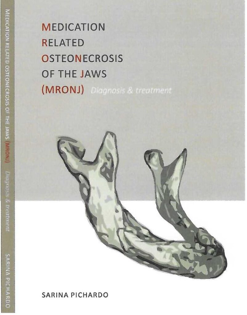 Medication Related Osteonecrosis of the Jaws (MRONJ) - Diagnosis ...